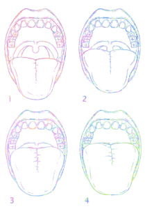 Mallampati Classification – 5minuteairway